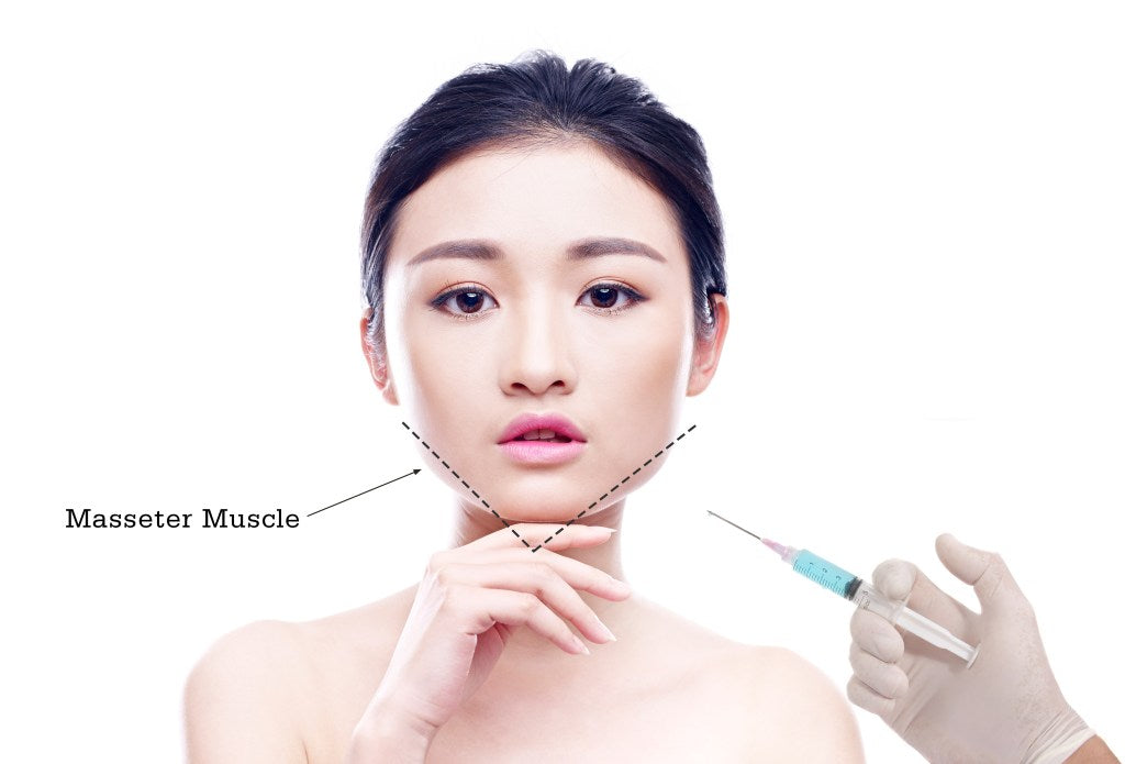 V-Shaped Face Phenomenon: Why Botox Injections Is Taking Melbourne By ...